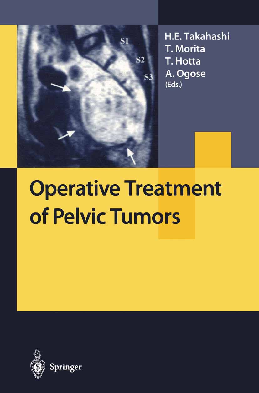 Operative Treatment of Pelvic Tumors 1 St - Shop Apotheke