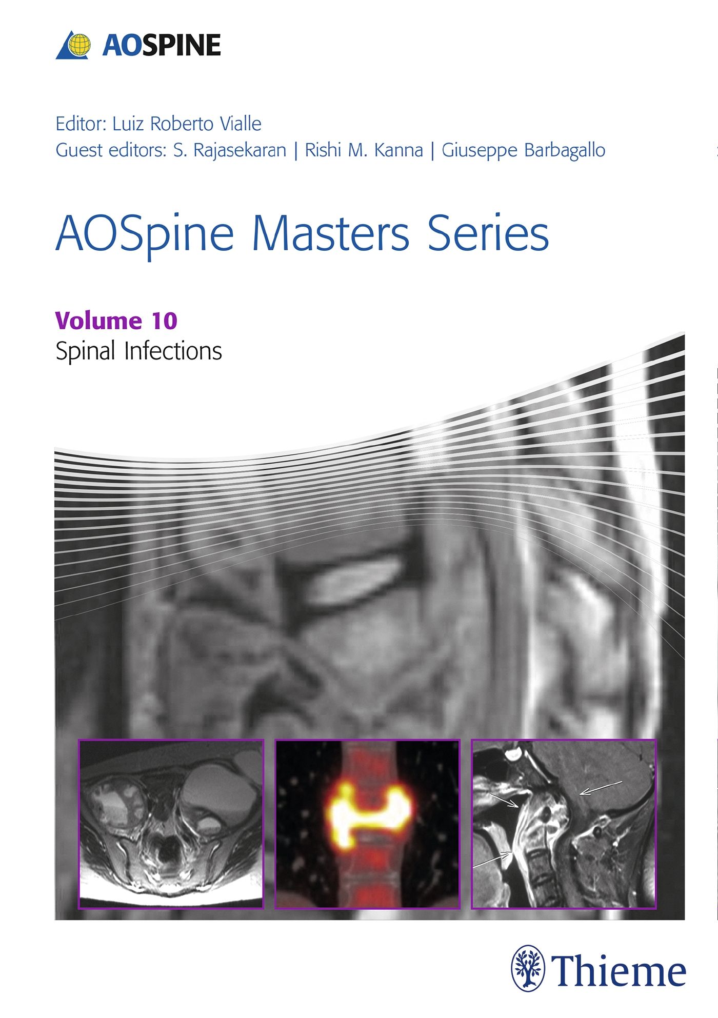 AOSpine Masters Series, Volume 10: Spinal Infections 1 St - Shop Apotheke